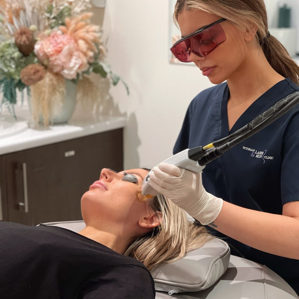 Vascular Laser Treatment - Pre & Post Treatment | Victorian Laser ...