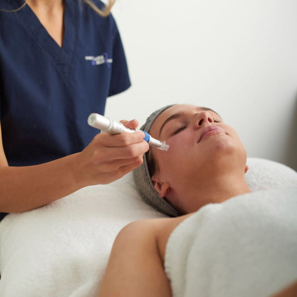 Skin Needling Melbourne - Microneedling & Derma Rolling Treatment ...