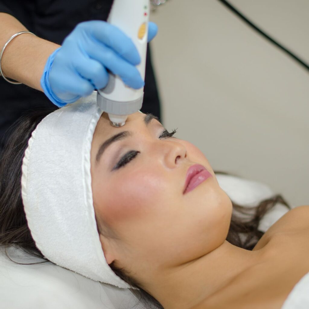 RF Skin Tightening Melbourne - Face, Chin, Stomach | Victorian Laser ...